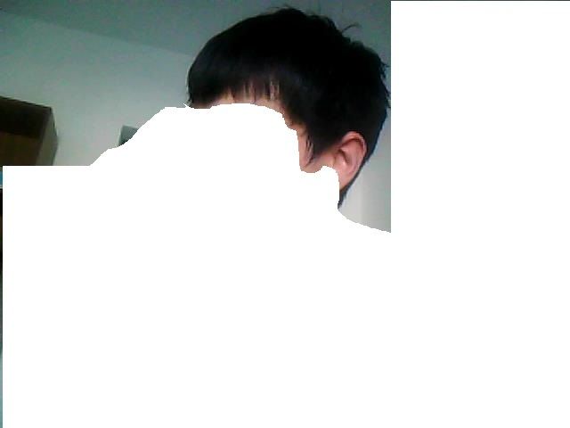 Am I receding (pics) : r/tressless